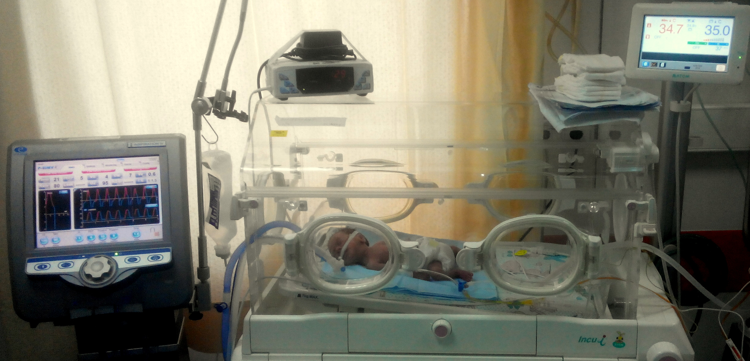 Μονάδα Εντατικής Νοσηλείας Νεογνών - ΓN Ηρακλείου Βενιζέλειο