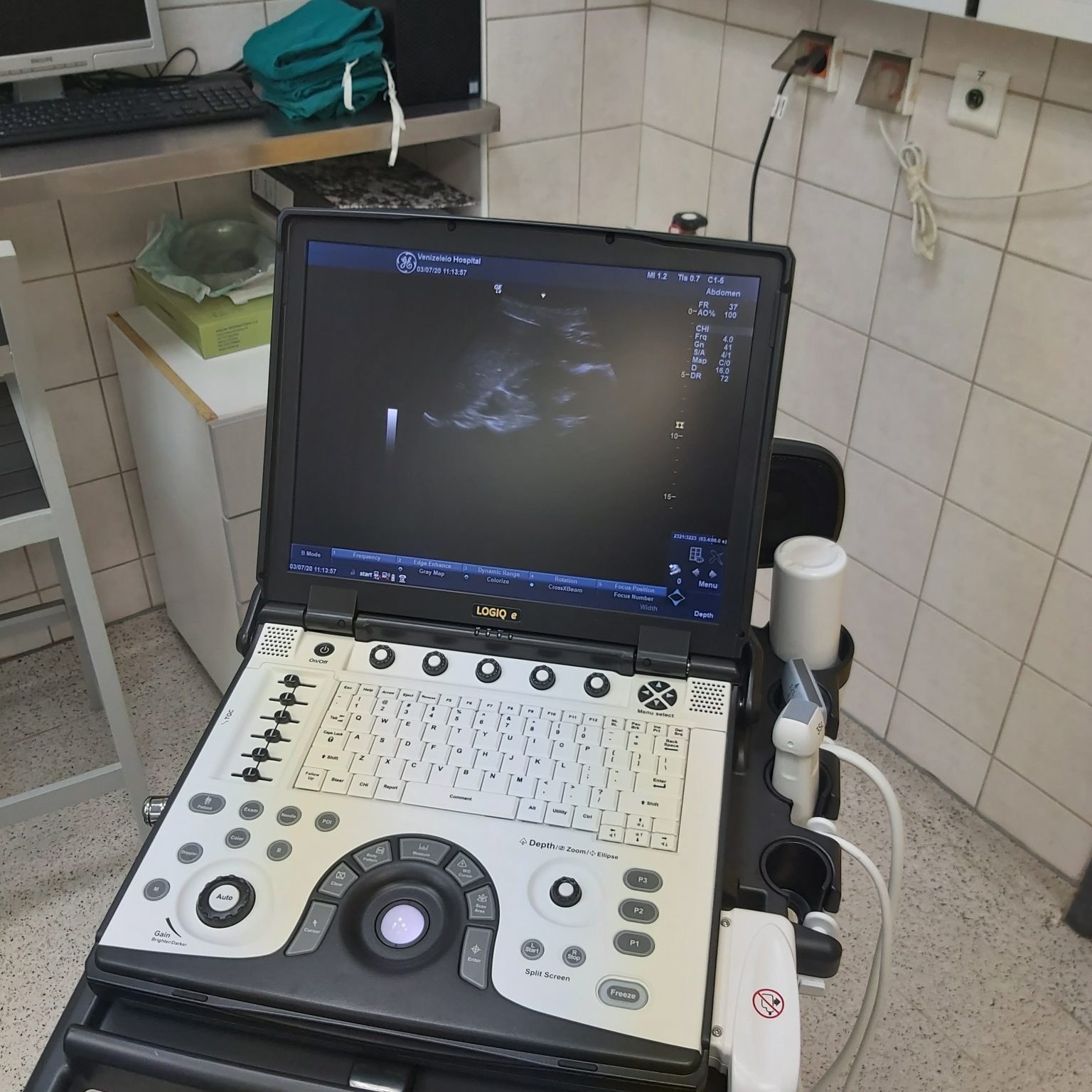 ΠΑΡΑΛΑΒΗ ΥΠΕΡΗΧΟΤΟΜΟΓΡΑΦΟΥ ΓΙΑ ΤΙΣ ΑΝΑΓΚΕΣ ΤΟΥ ΤΜΗΜΑΤΟΣ ΕΠΕΙΓΟΝΤΩΝ ...